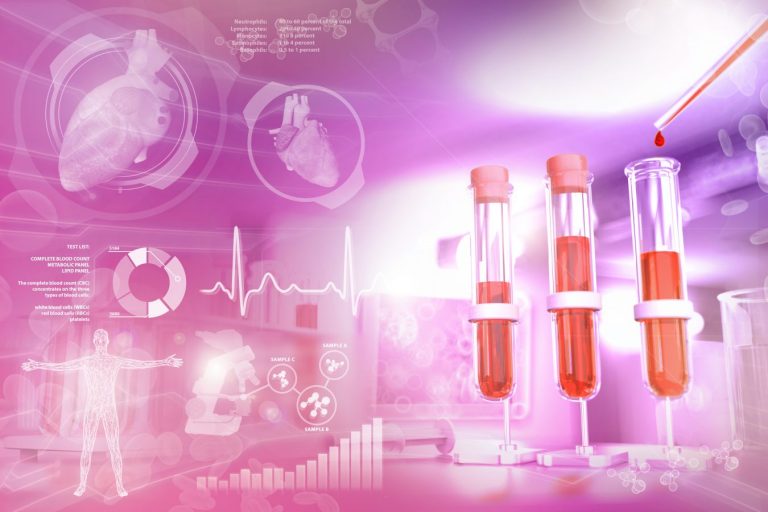 Despre trombocitopenie sau scăderea numărului de trombocite - Revista ...
