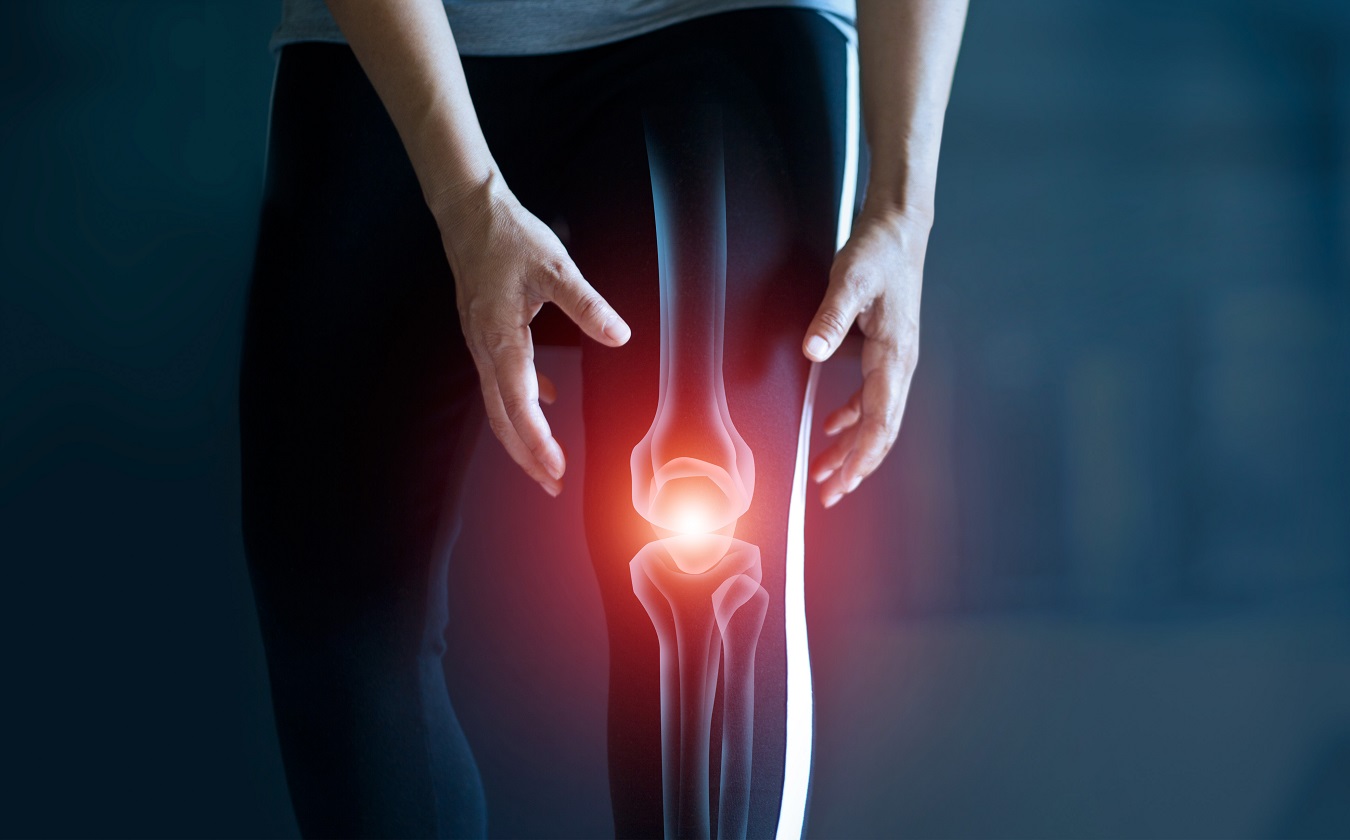 Artroza (osteoartrita) – cauze, simptome și abordări terapeutice ...